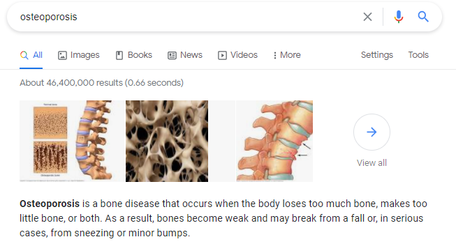 Dino species confirmation- ostreopsis? | Reef2Reef