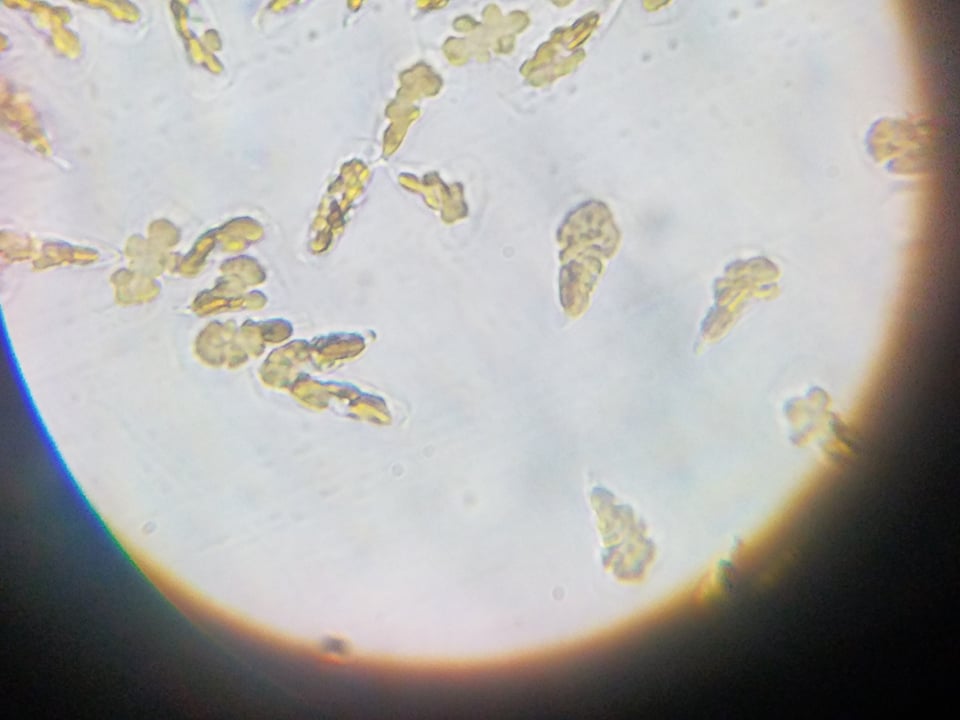 Brown Algae Under Microscope