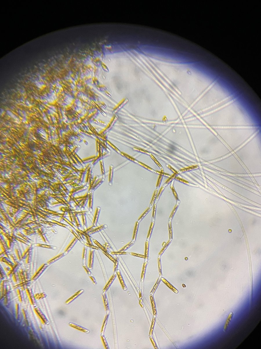 Diatoms finally? | Reef2Reef