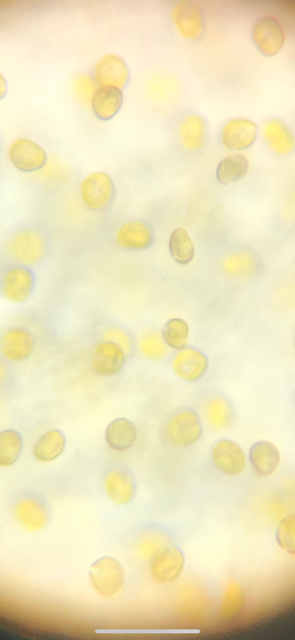 Help me identify this algae? Looks like Dino-Coolia-Please see pics ...