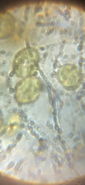 Help me identify this algae? Looks like Dino-Coolia-Please see pics ...