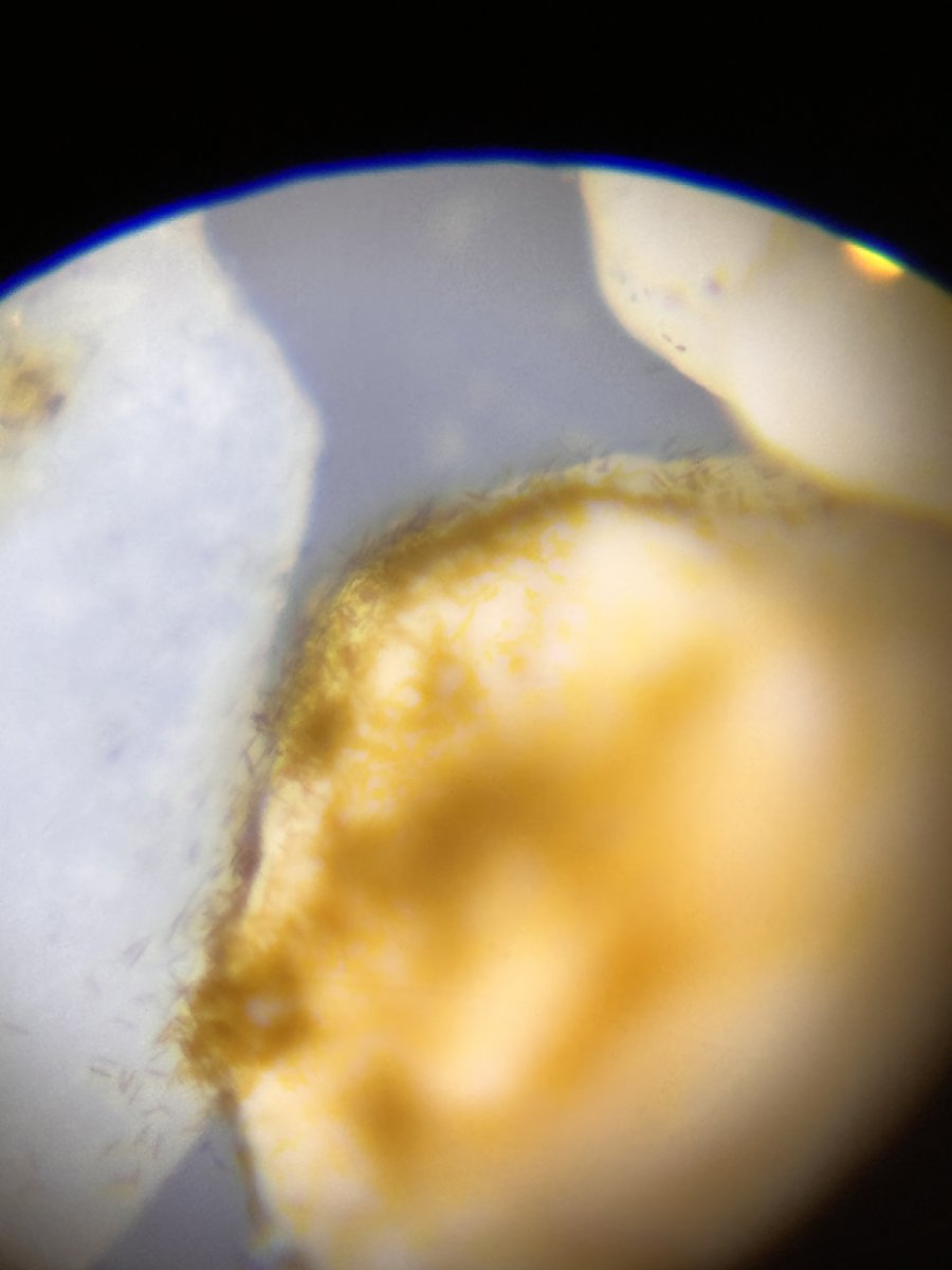 Dino or Diatom? | Reef2Reef