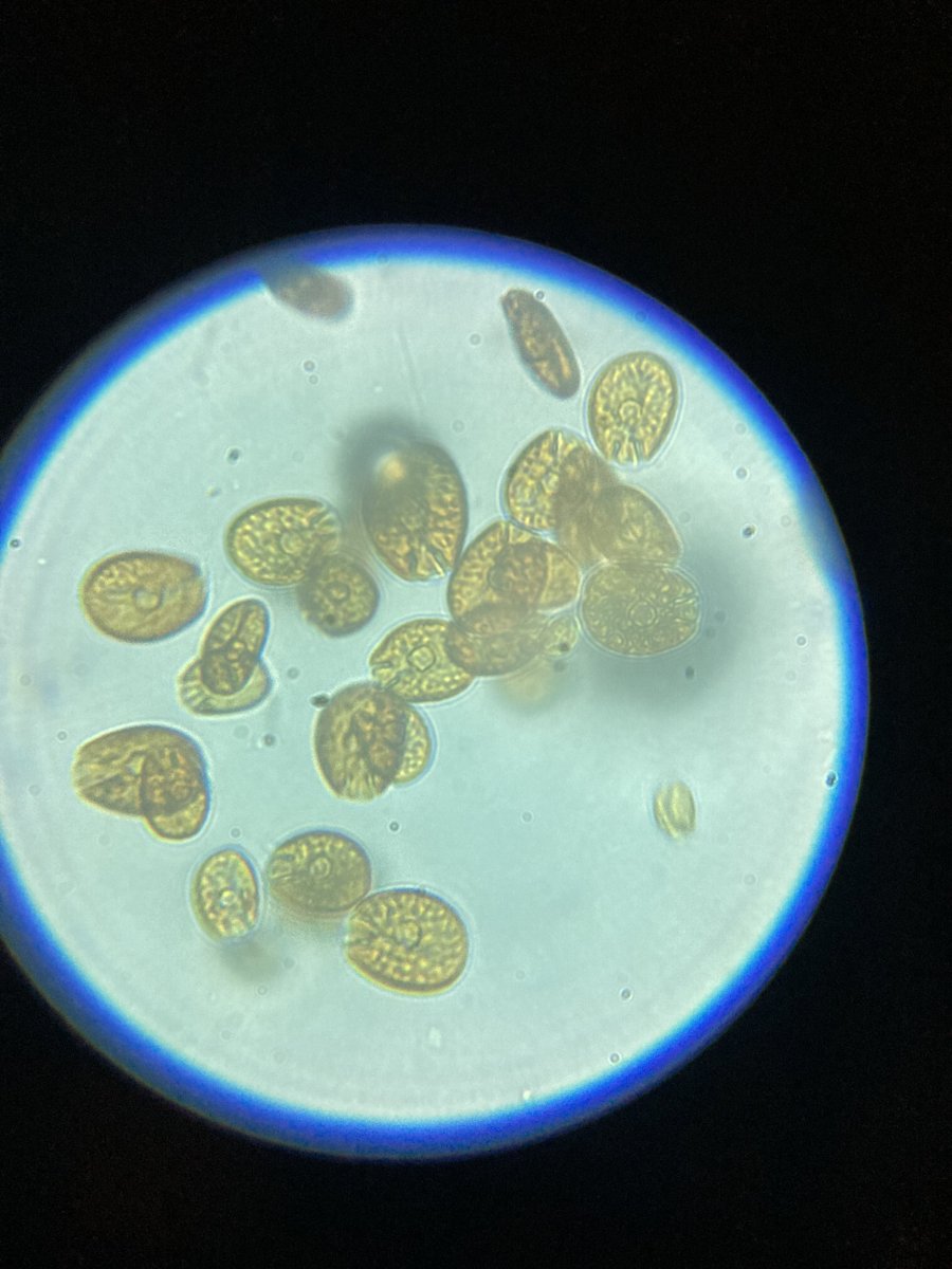 Dino ID w/ microscope | Reef2Reef